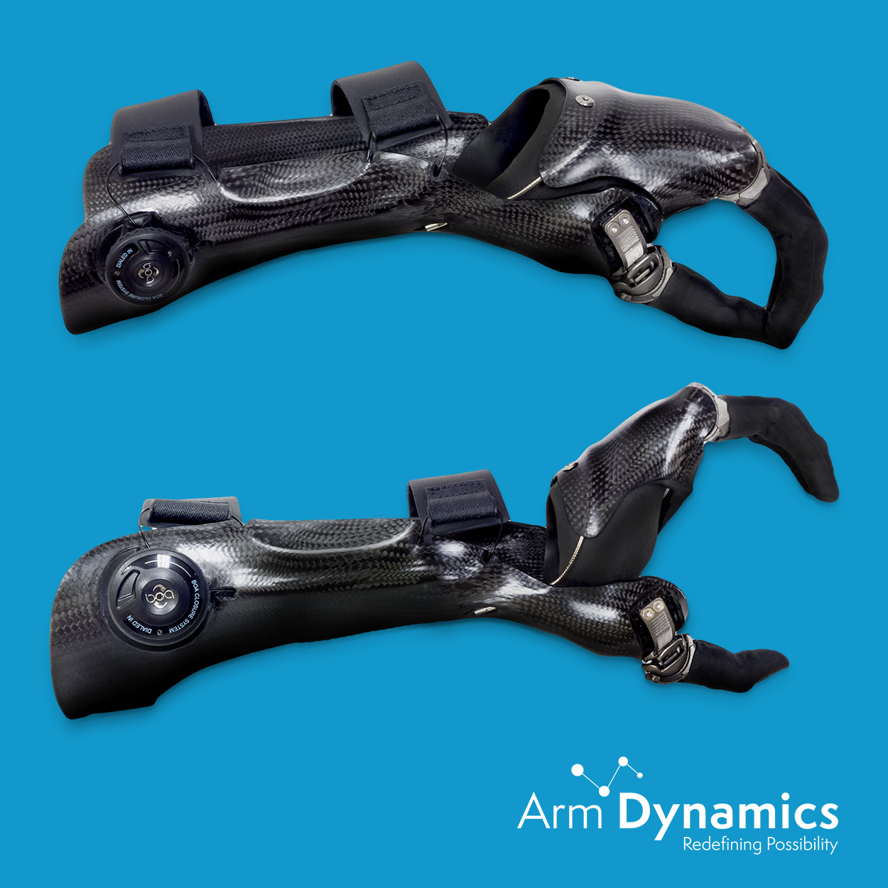 What is a Hybrid Upper Limb Prosthesis?
